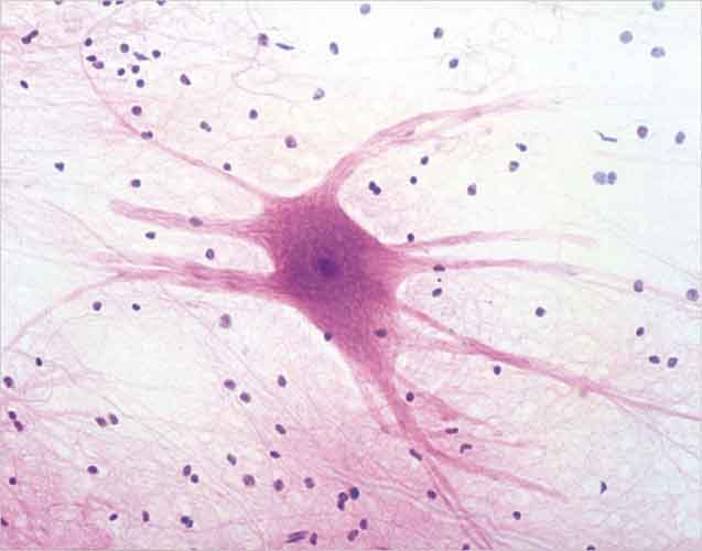 Motor Neuron Slide